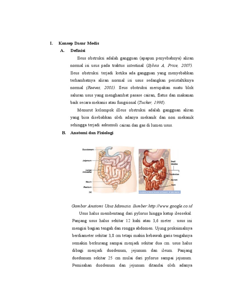 LP ILEUS OBSTRUKSI Yg Betul | PDF
