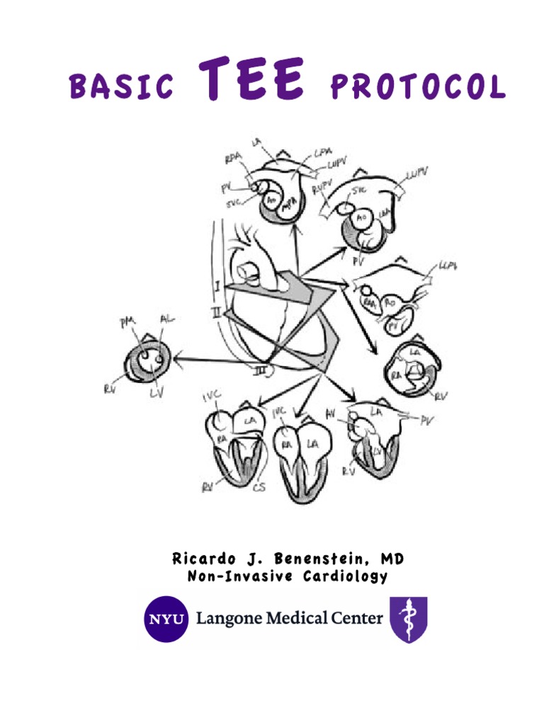 Benenstein Basic Tee Protocol | PDF | Heart Valve | Echocardiography