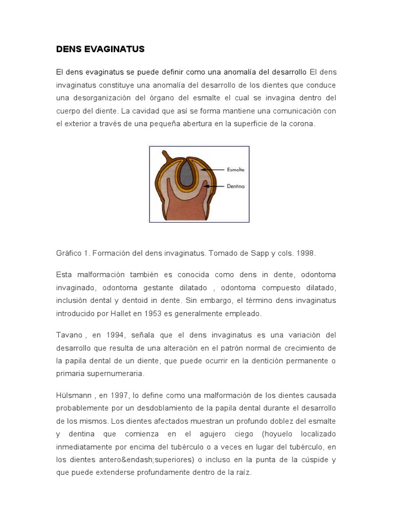 Dens Evaginatus | PDF | Diente | Esmalte de dientes