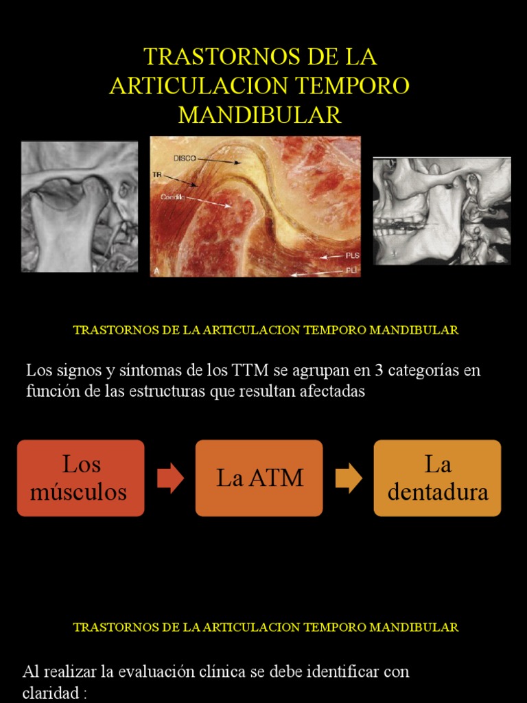 Trastorno Atm Clase | PDF | Dolor | Músculo
