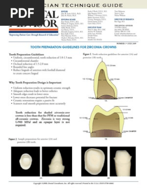 Zirconia Crown Prep