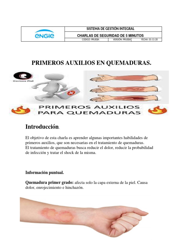 Charla 5 Minutos Primeros Auxilios en Quemaduras Edward | PDF | Primeros auxilios | Quemar