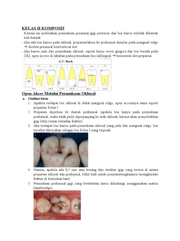 Restorasi Resin Komposit Kelas Ii | PDF | Sains & Matematika
