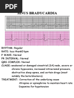 Basic Arrhythmia Rules | PDF | Electrocardiography | Physiology