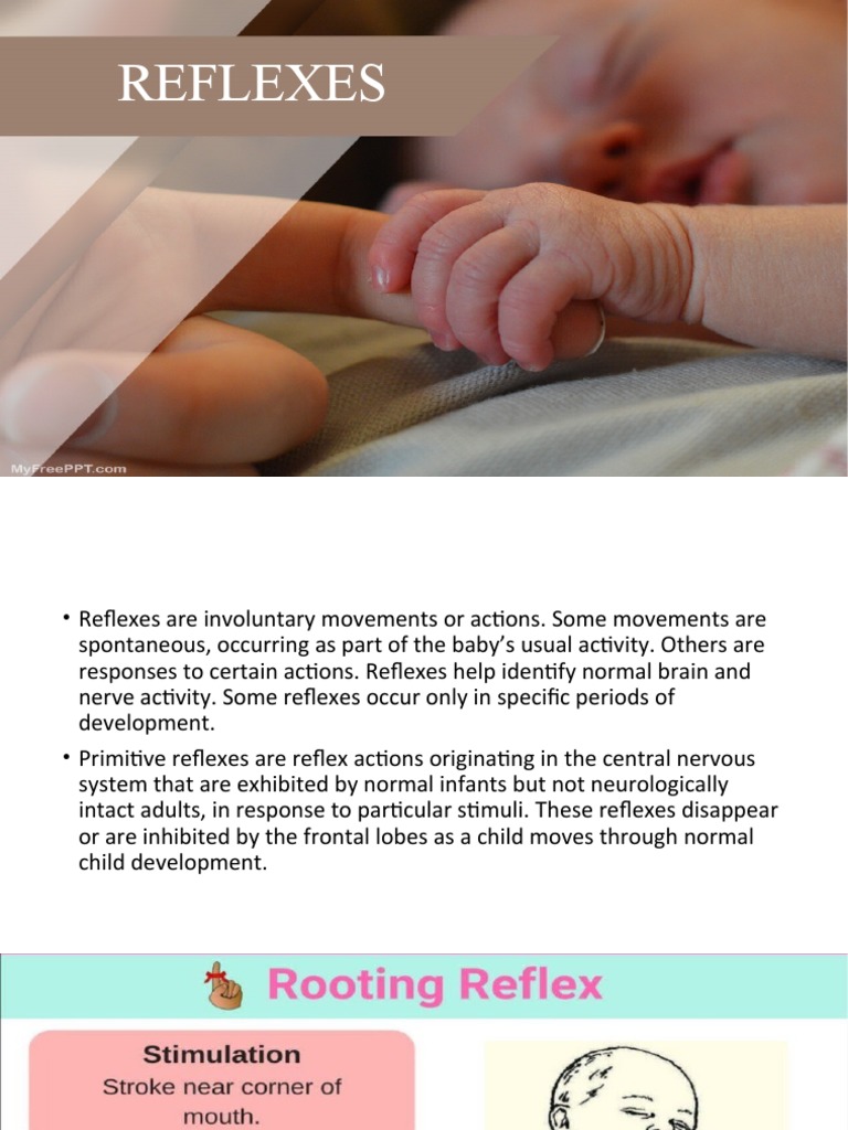 Newborn Reflexes | PDF