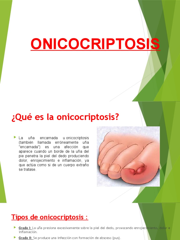 ONICOCRIPTOSIS | PDF | Clavo (anatomía) | Cirugía