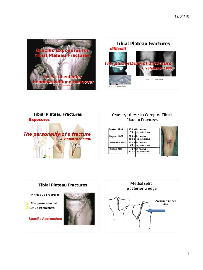 LOBENHOFFER Approach | PDF | Knee | Musculoskeletal System