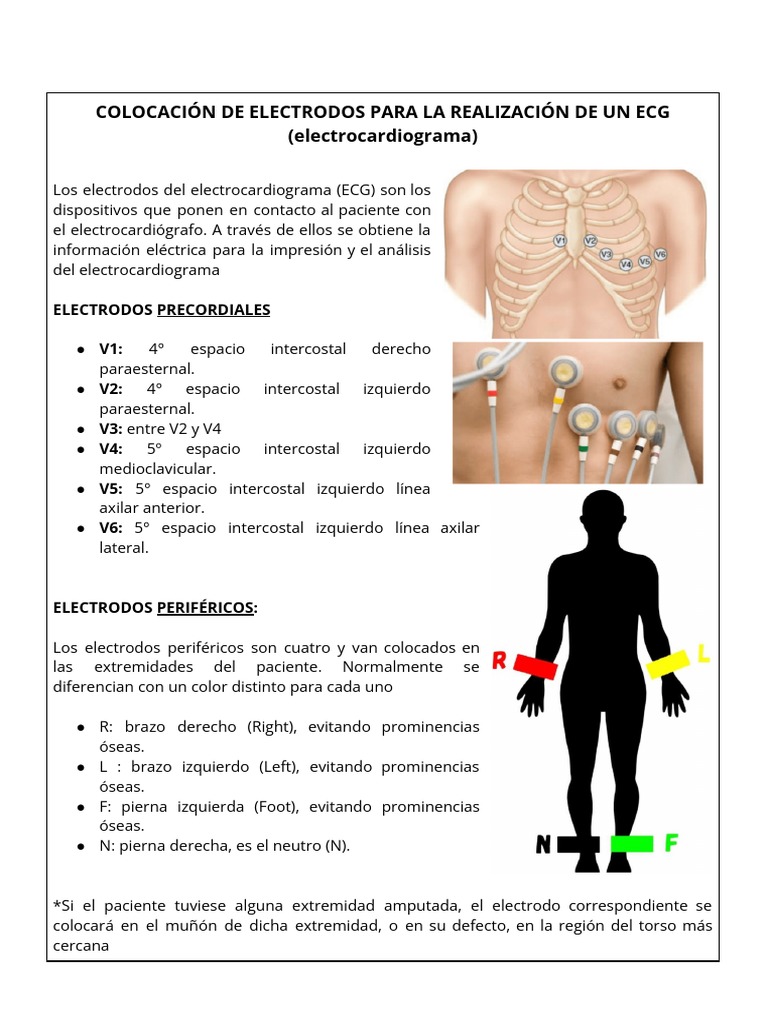 COLOCACIÓN DE ELECTRODOS PARA LA REALIZACIÓN DE UN ECG ...