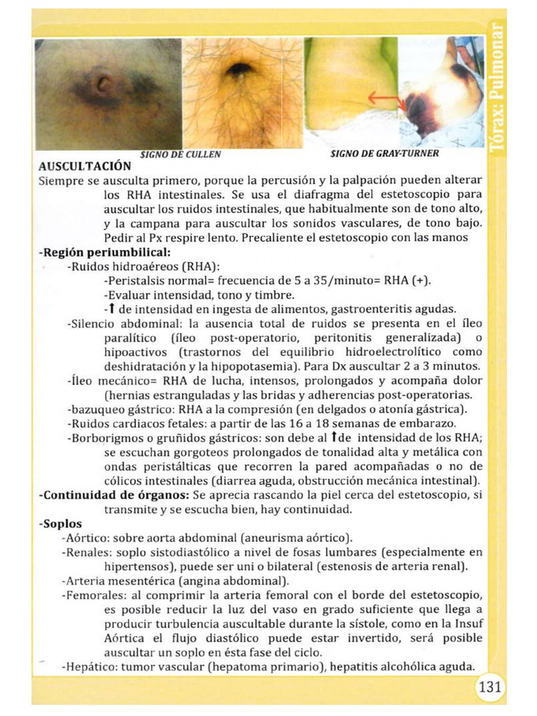 Signo D E Cullen Signo de Crayturner | PDF | Medicina CLINICA ...