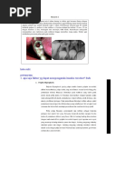 Hiperplastik Pulpitis Kronis | PDF