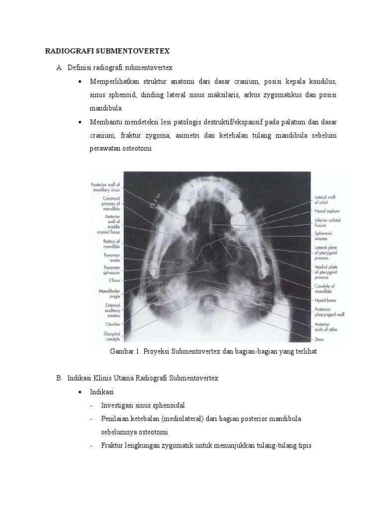 Radiografi Submentovertex | PDF
