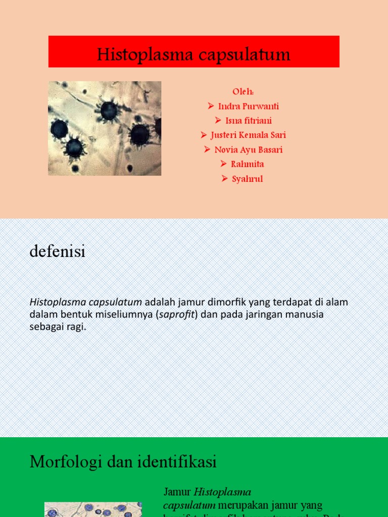 Histoplasma Capsulatum | PDF