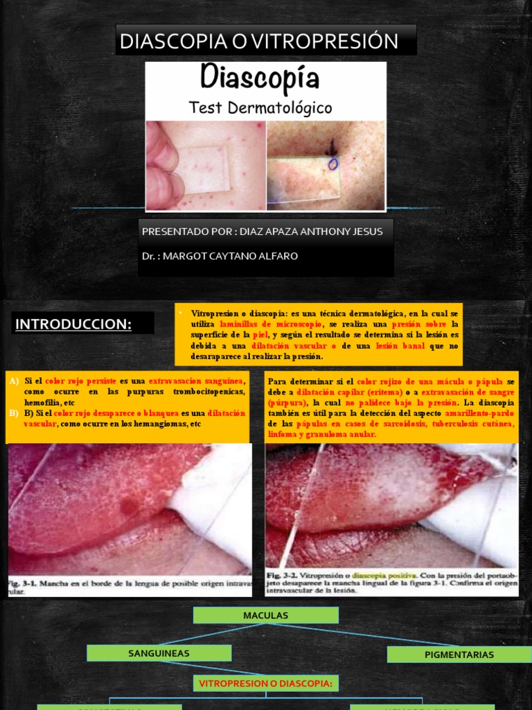 Diaz Apaza Anthony Jesus-Diascopia - Vitropresion | Descargar gratis ...