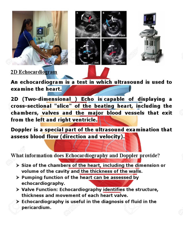 2D Echocardiogram (Bulletin) | PDF