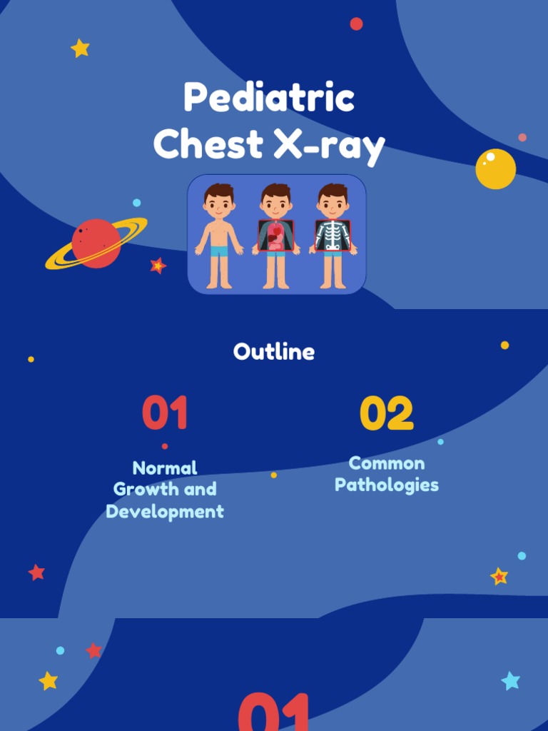 Pediatric Chest X-Ray | Download Free PDF | Congenital Heart Defect | Heart
