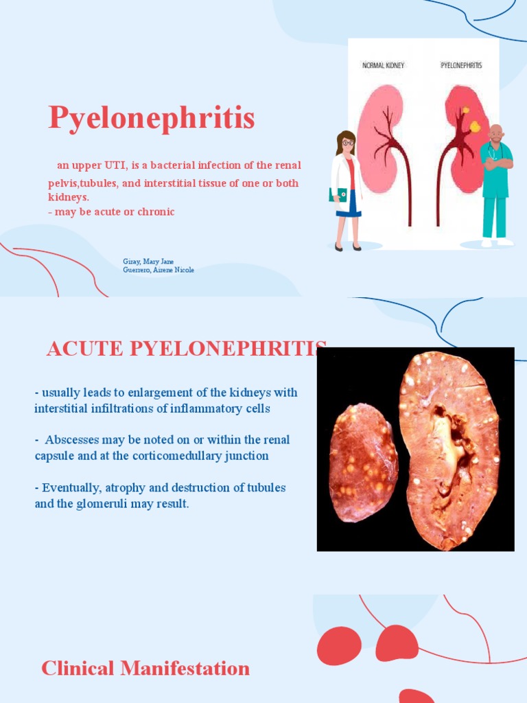 PYELO | PDF | Urinary Tract Infection | Planets