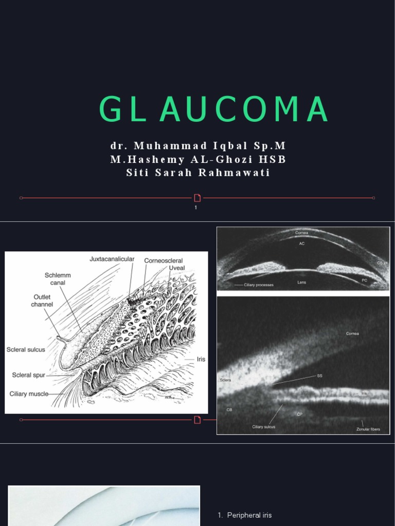Glaucoma | Download Free PDF | Glaucoma | Clinical Medicine