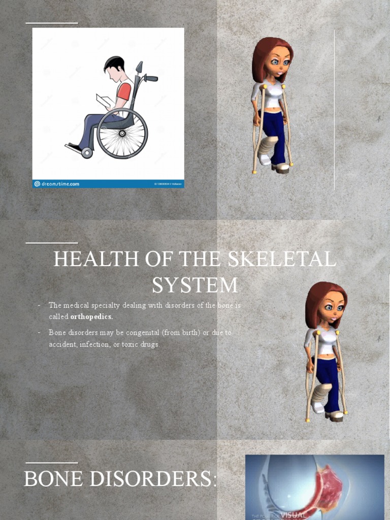 Lesson 5 Health of The Skeletal System | PDF | Bone | Arthritis