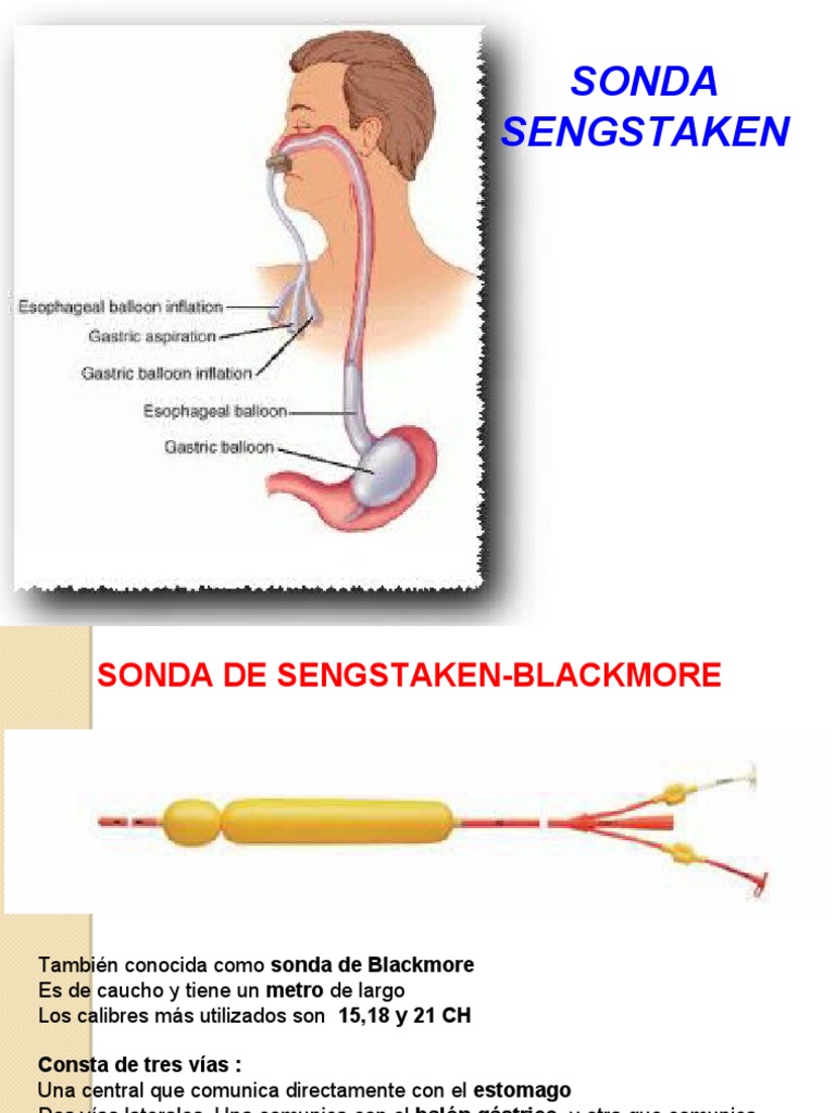 Sonda Sengstaken | PDF | Especialidades Medicas | Medicina CLINICA