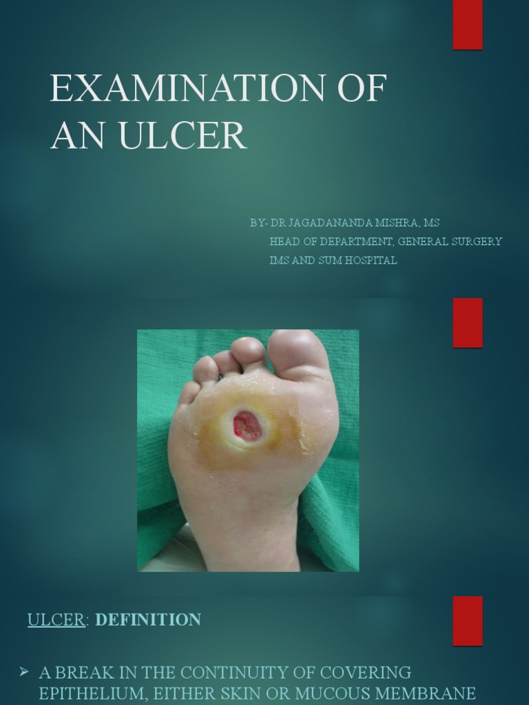 Examination of An Ulcer | PDF | Epithelium | Skin