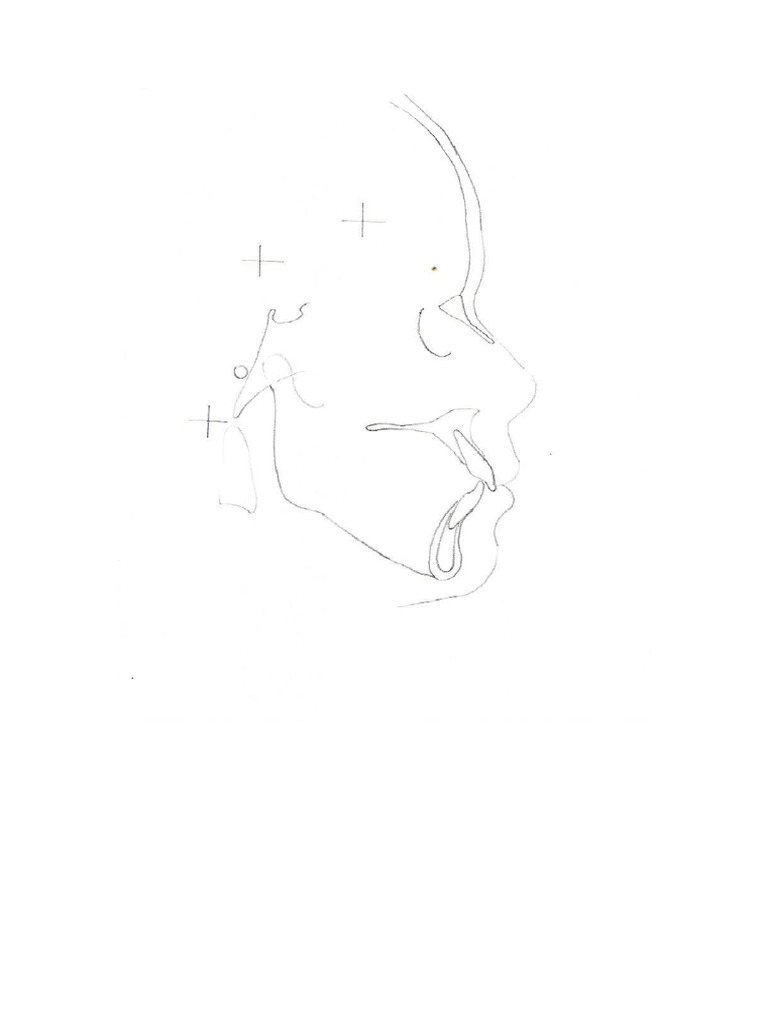 Sefalometri Lateral | PDF