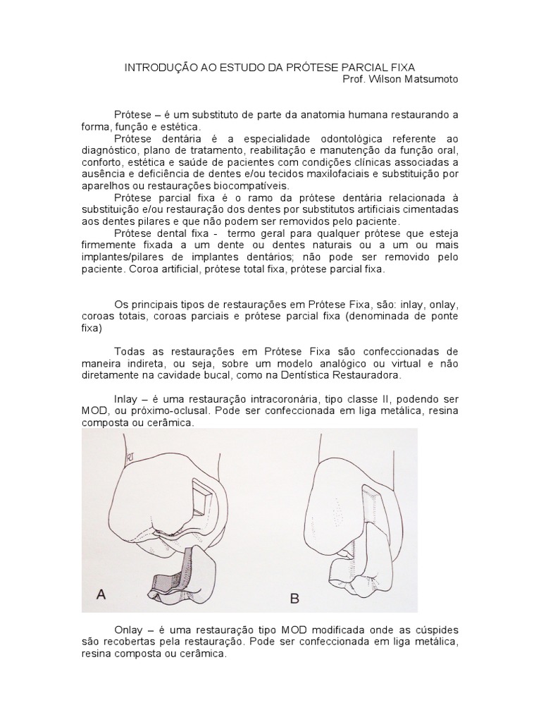 Resumo Prótese Parcial Fixa | PDF | Dentaduras | Prótese