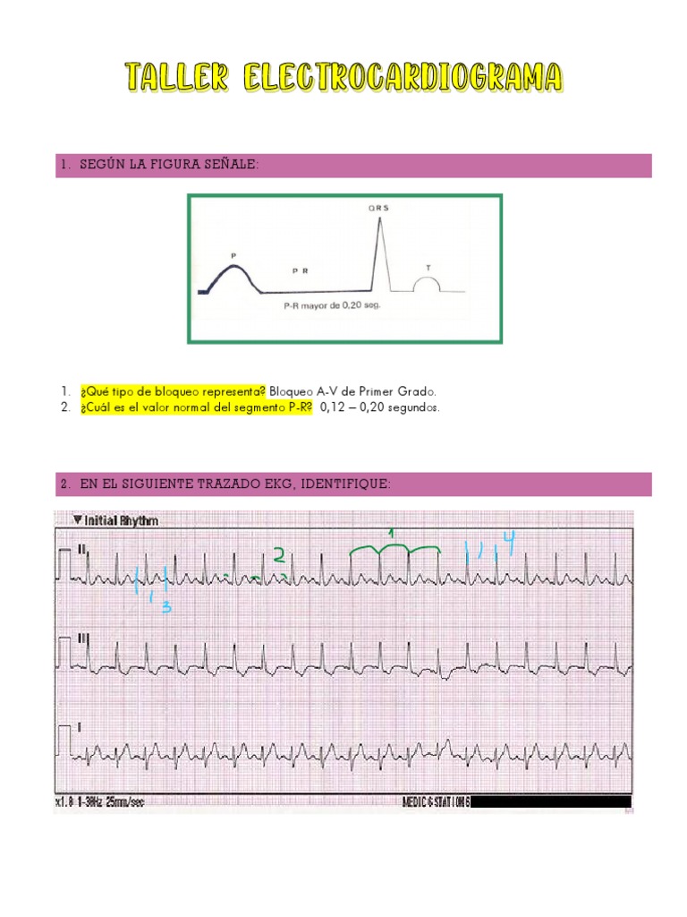 ELECTROCARDIOGRAMA | PDF | Electrocardiografia | Medicina Interna