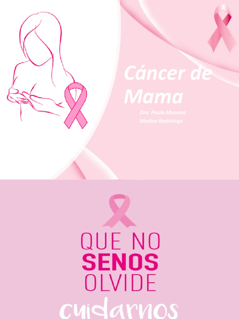 Cancer de Mama Dra Paula Messina | PDF | Cáncer de mama | Cáncer