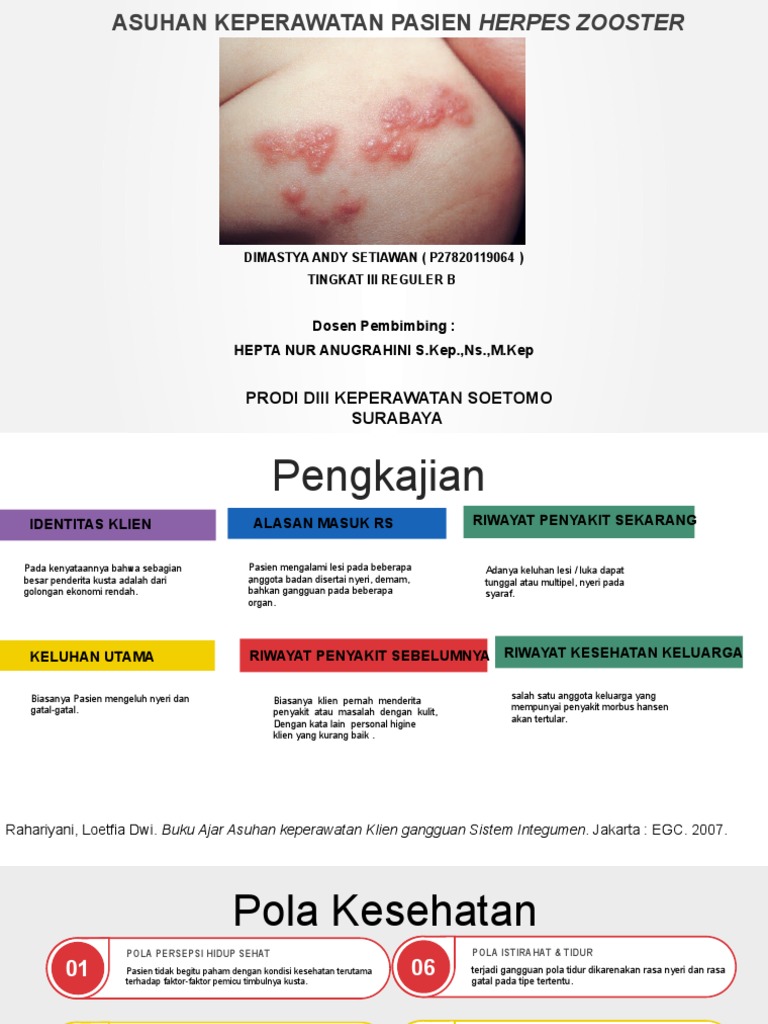 Askep Morbus Hansen | PDF