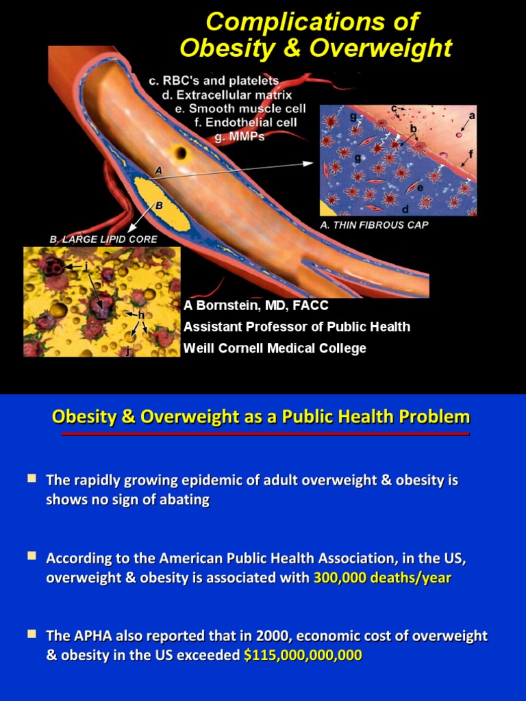 A Bornstein, MD, FACC Assistant Professor of Public Health Weill ...