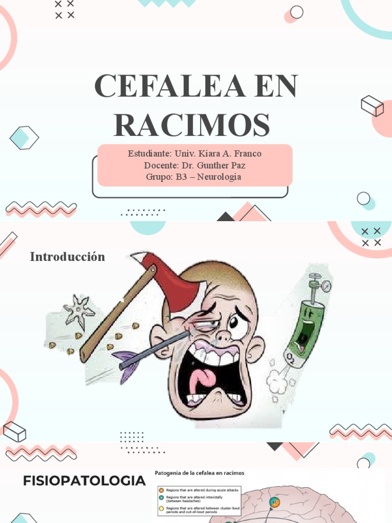 Cefalea en Racimos | PDF