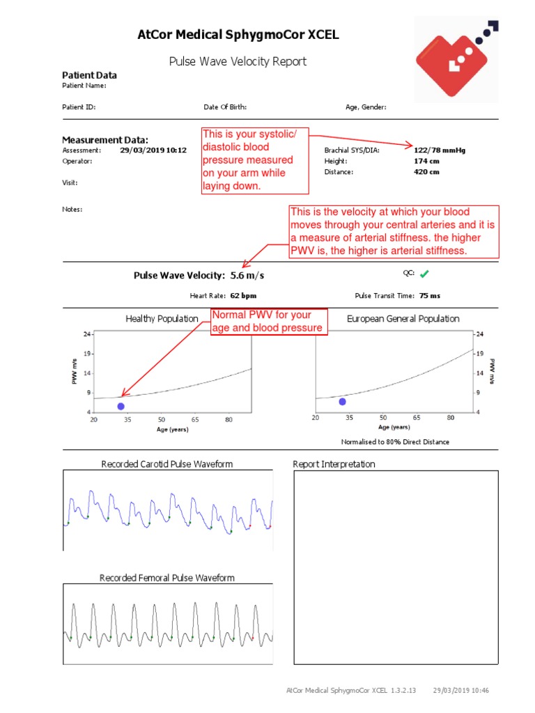 Atcor Medical Sphygmocor Xcel: Pulse Wave Velocity Report | PDF
