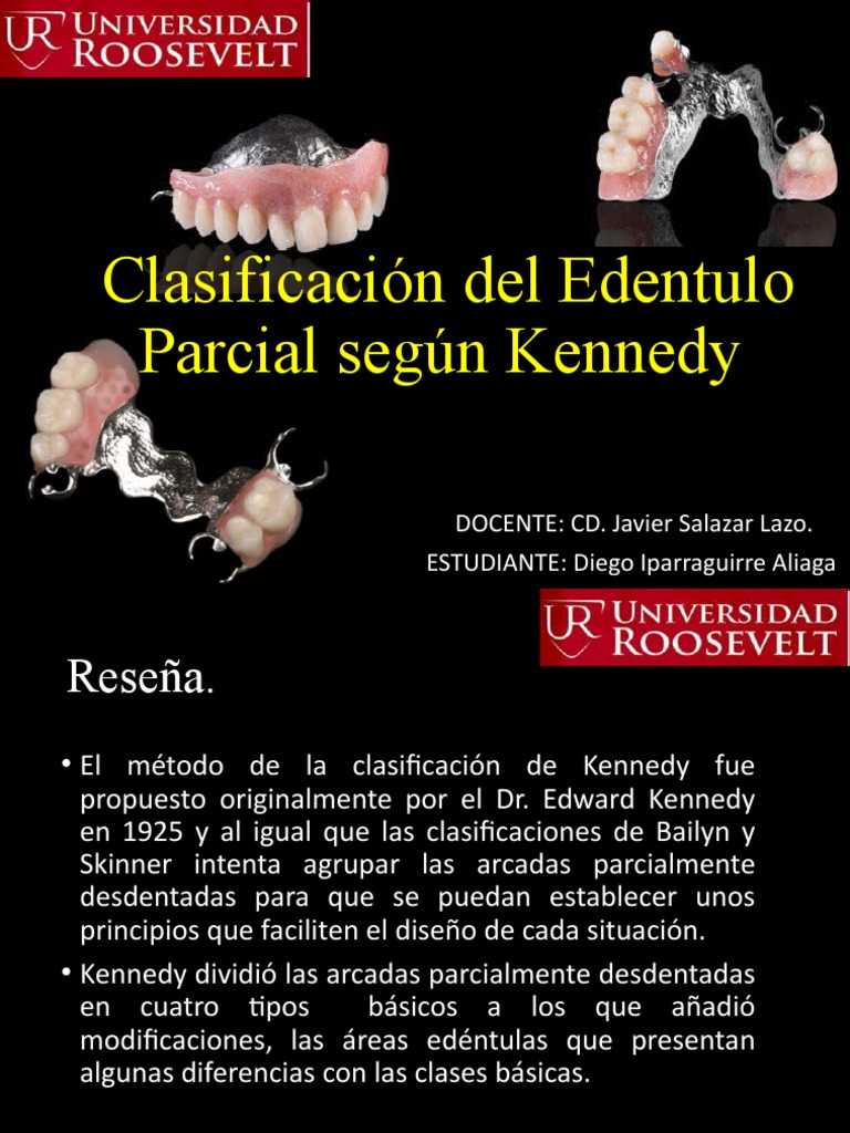 Clasificación Del Edentulo Parcial Según Kennedy | PDF | Dentadura ...
