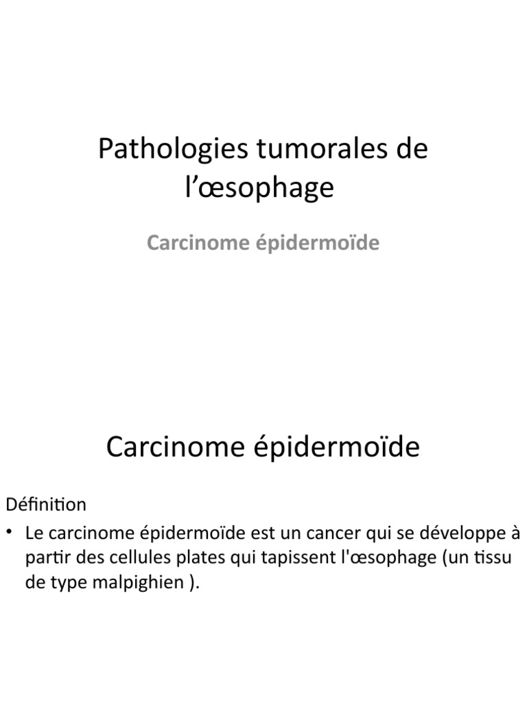 Carcinome Epidermoide | PDF | Cancer de l'œsophage | Maladies et troubles