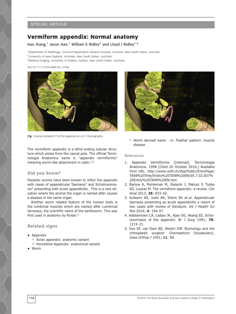 Vermiform Appendix: Normal Anatomy: Hao Xiang, Jason Han, William E ...