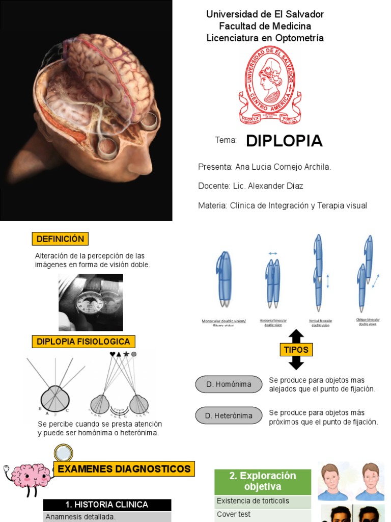 Diplopia | PDF | Percepción visual | Enfermedades y trastornos