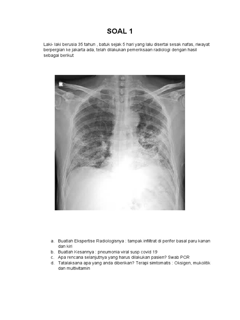 SIMULASI OSCE Paket Soal 2 | PDF | Pengembangan Diri | Kesehatan Holistik