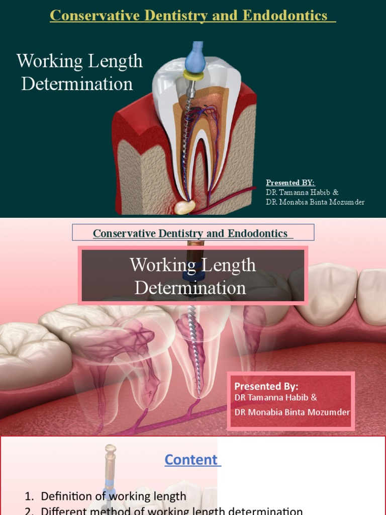 Endodontic Working Length Guide | PDF | Radiography | Mouth