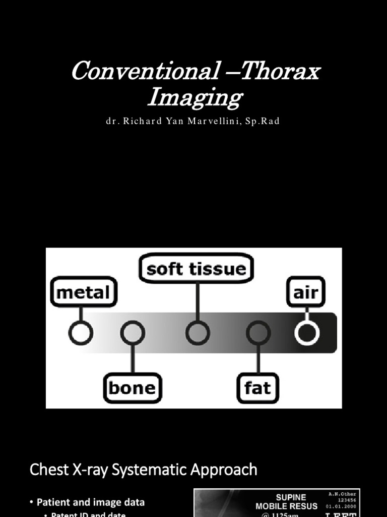Interpretasi RO Paru Normal - DR Richard | PDF