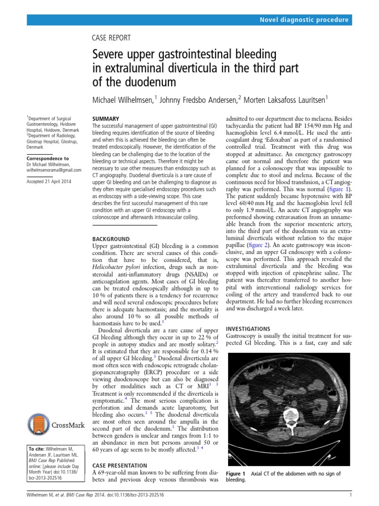 Severe Upper Gastrointestinal Bleeding in Extraluminal Diverticula in ...