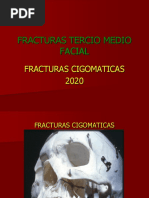 Triangulo de Farabeuf | PDF | Anatomía humana | Cabeza y cuello humanos