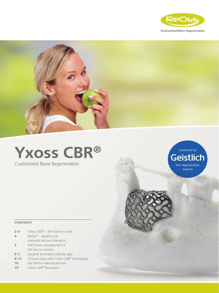 Yxoss CBR: Customized Bone Regeneration | PDF | Dental Implant | Tissue ...