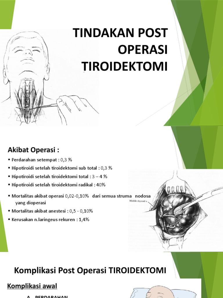 Tindakan Post Operasi Tiroidektomi | PDF