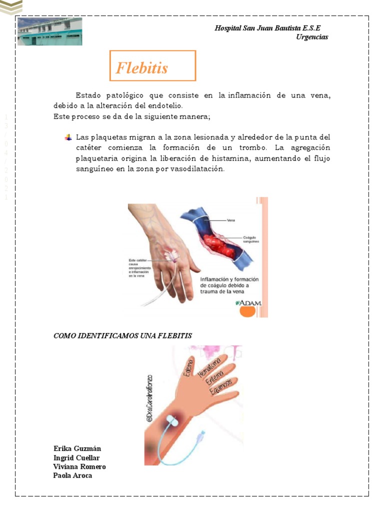 Guía de Flebitis y Cuidados de Enfermería | PDF | Terapia intravenosa ...