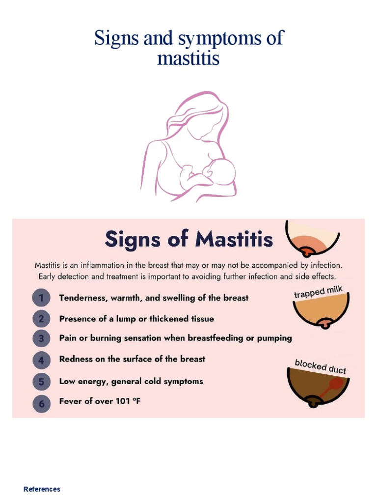 نسخة Signs and symptoms of mastitis | PDF