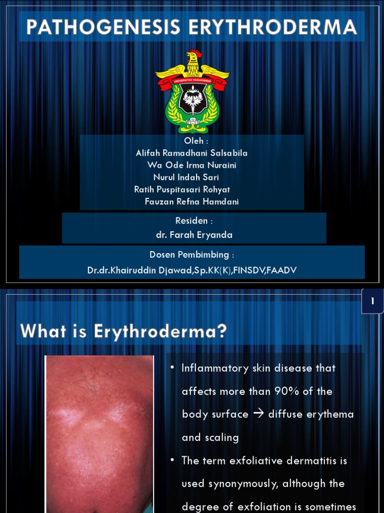 Pathogenesis of Erythroderma (3B) | PDF | Dermatitis | Psoriasis