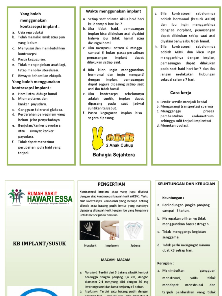 Implan | PDF