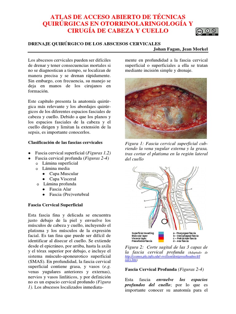 Drenaje Quirúrgico de Los Abscesos Cervicales | PDF | Anatomía humana ...