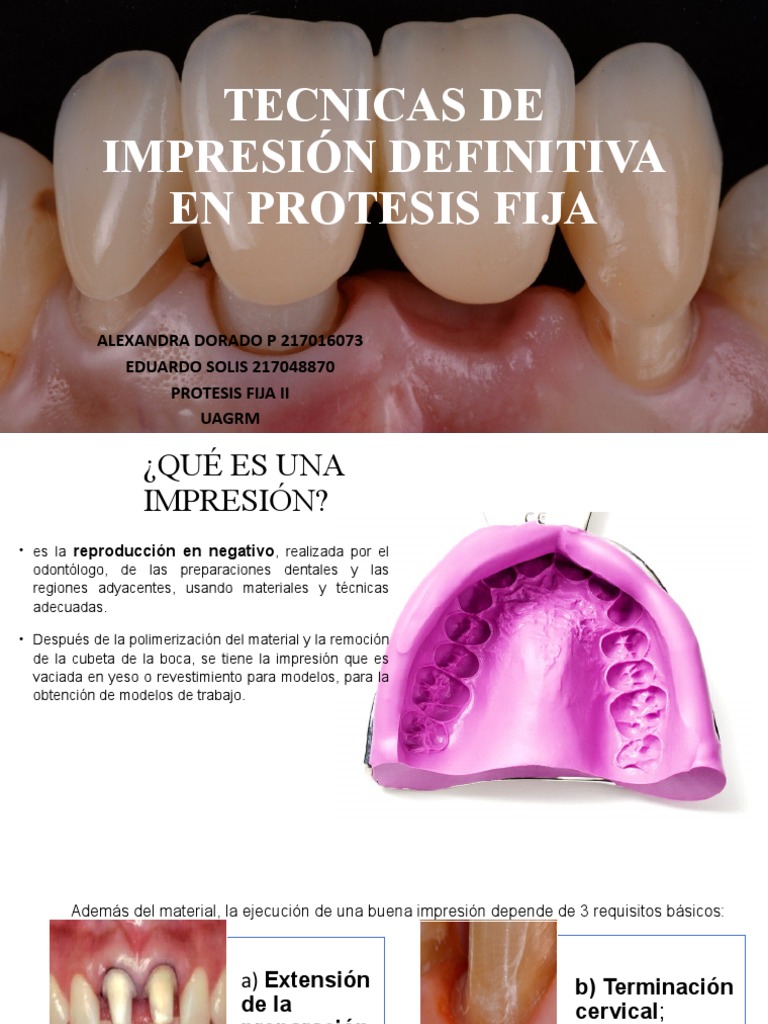 Técnicas de Impresión Definitiva Dental | PDF | Dentadura postiza ...