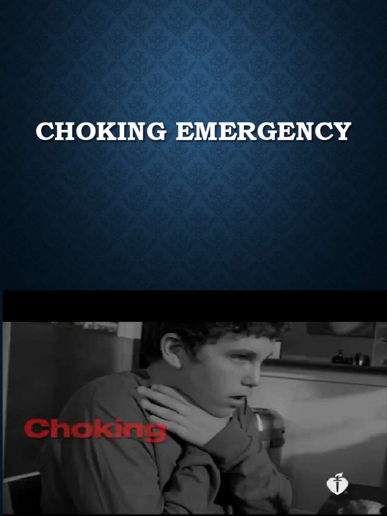 Choking Management | PDF